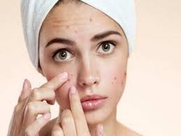 Jerawat Meradang Harus Pakai Apa? - Galuh.ID